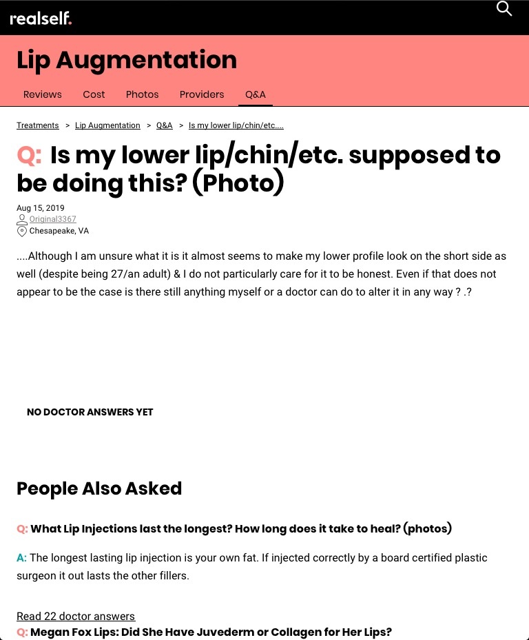 RealSelf Reviews - 87 Reviews of Realself.com | Sitejabber